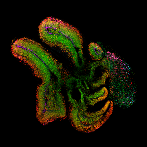 Adey Lab | High throughput epigenomics